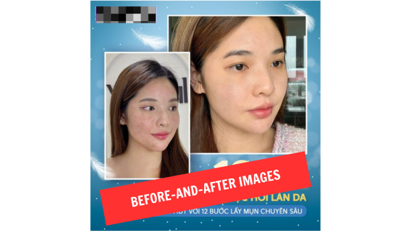 Facebook Ad Account is restricted? How to fix like a Master